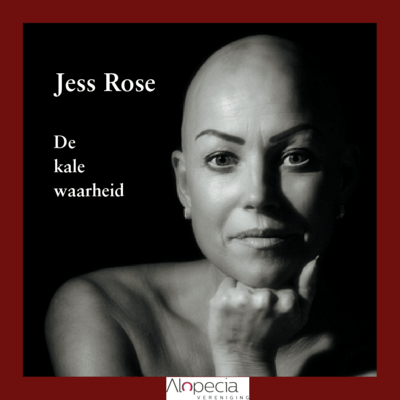 Jess Rose - Alopecia Vereniging